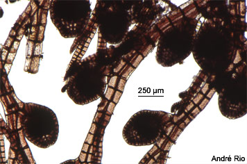 polysiphonia under microscope 40x