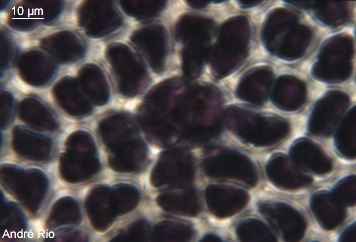 porphyra under microscope